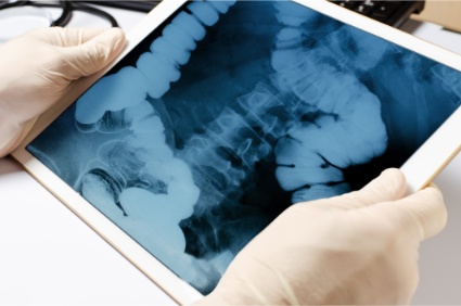 Procedures – Pinnacle Gastroenterology